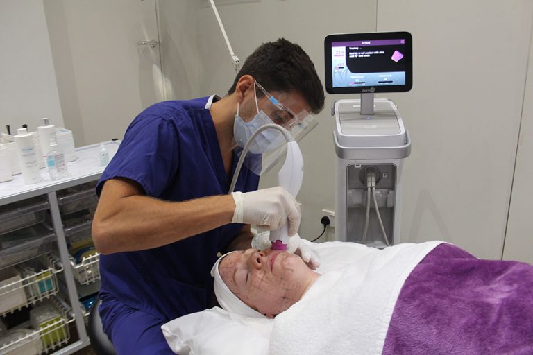 Laser Skin Tightening Treatments - Yag Laser Genesis, cynosure laser