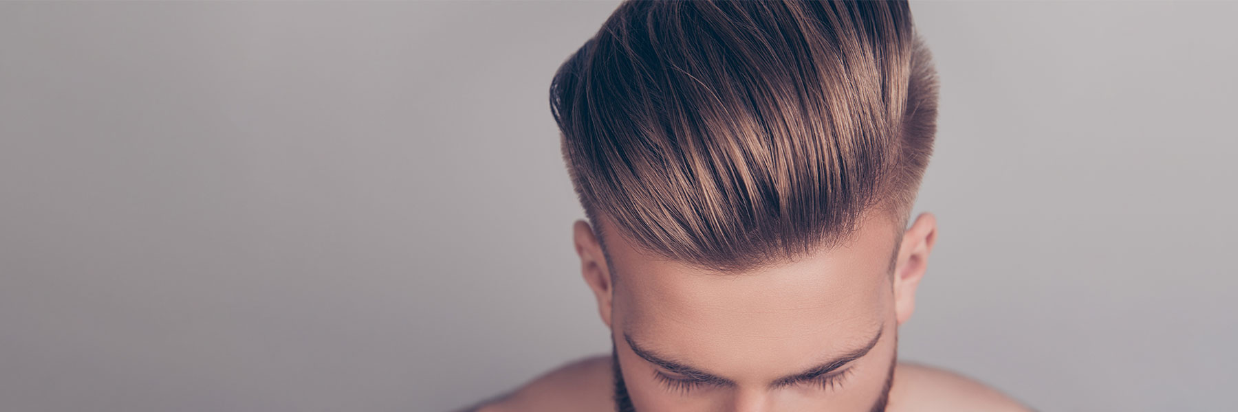 10 Years After A Hair Transplant What To Expect Long Term Hair