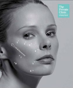 8 Point Lift, Non-Surgical Facelift using Dermal Fillers - Fluid ...