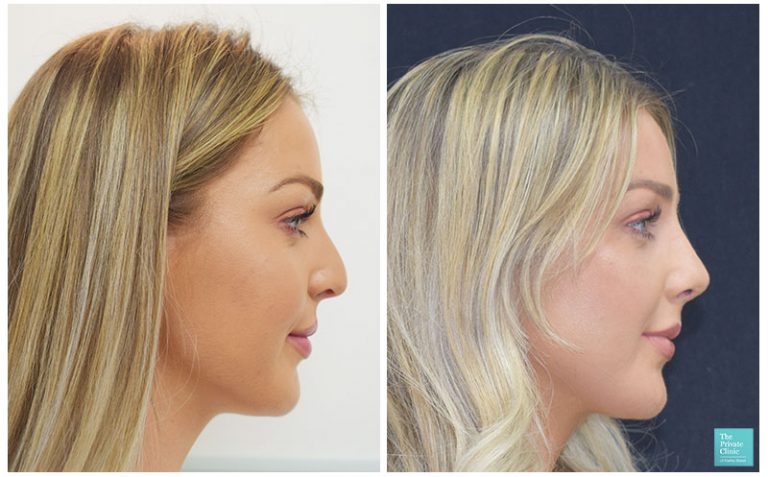 Plastic Surgery London, cosmetic procedures in London clinic near me ...