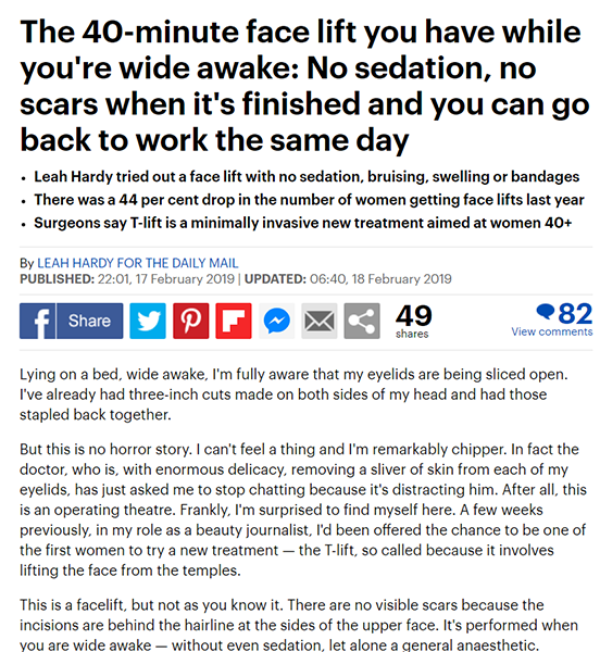 T-lift facelift London, Temporal lift surgery UK, before and after ...